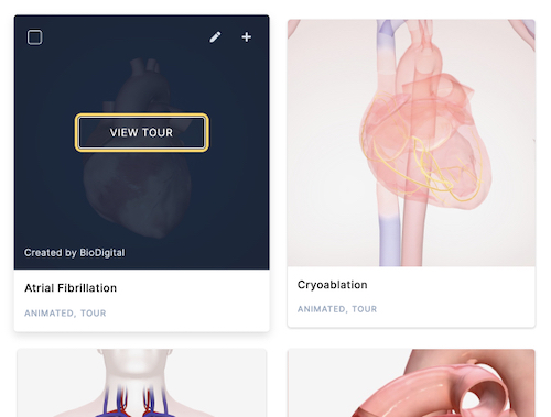 November 2020: Streamlined navigation in the Human Viewer – Human Support