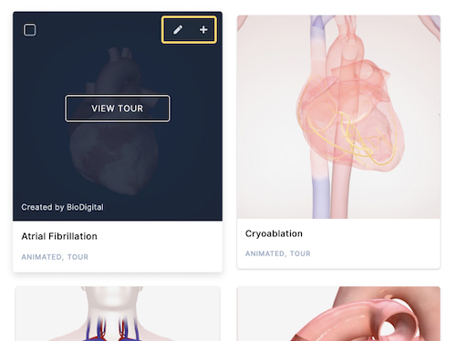 November 2020: Streamlined navigation in the Human Viewer – Human Support